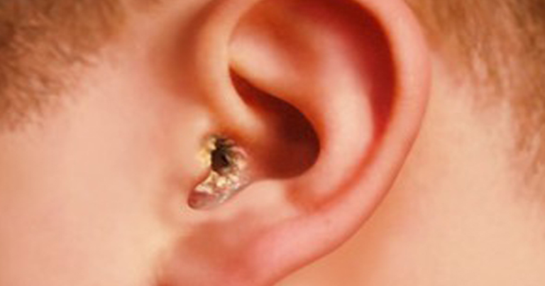 Services Ear Wax Removal – Unicare